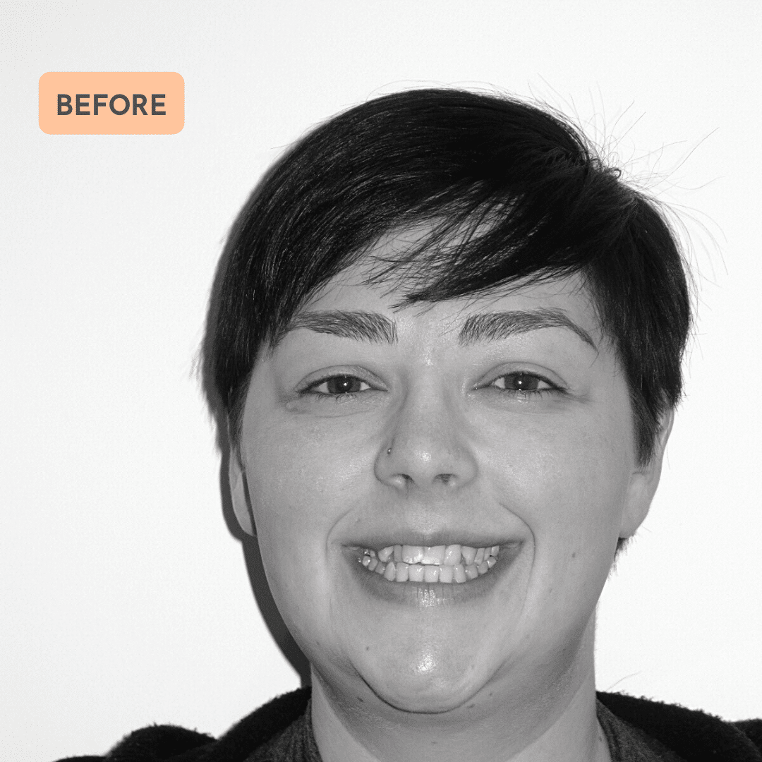 Adelaide's Accredited Braces Specialists With Over 20 years Experience