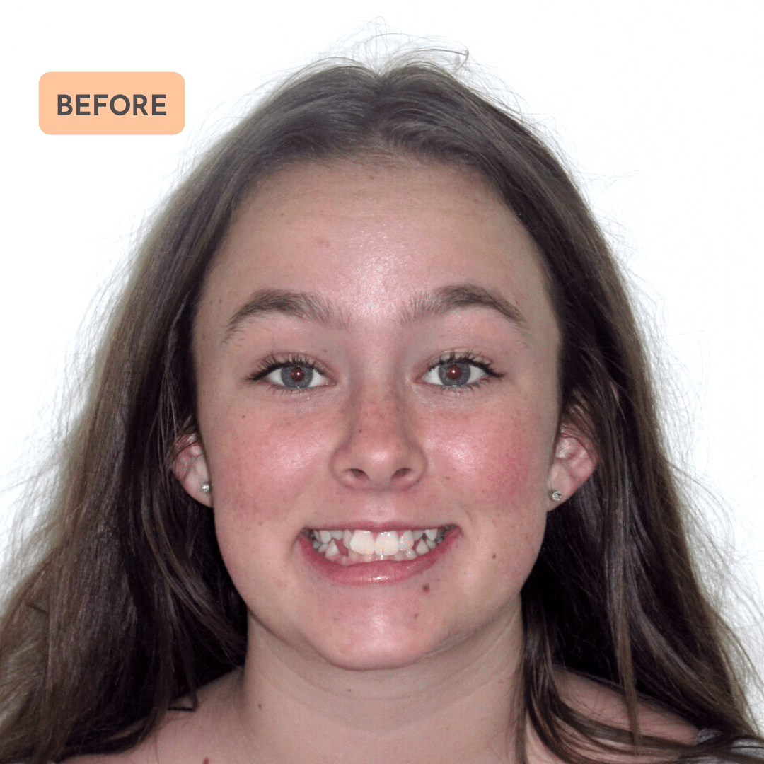 Adelaide's Accredited Braces Specialists With Over 20 years Experience